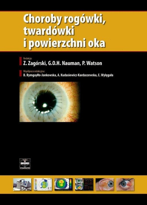 Choroby rogówki, twardówki i powierzchni oka - Księgarnia medyczna ...